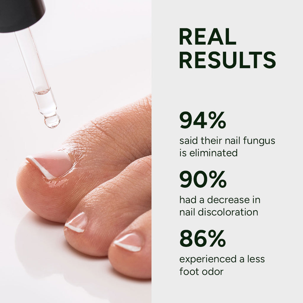 Anti-Fungal Repair Serum – NutraBoost
